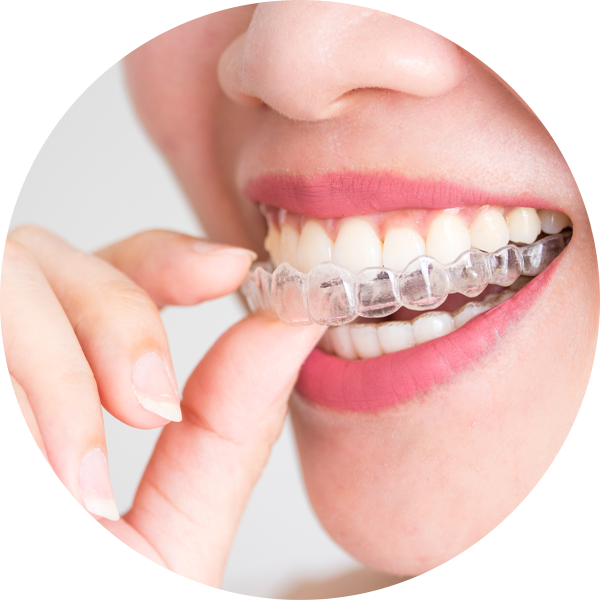 Try Our Clear Aligners - Mehta Orthodontics