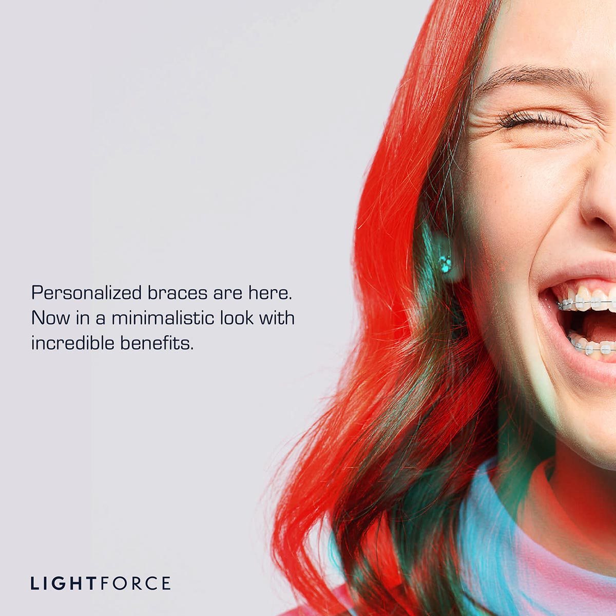 LightForce 3D Braces - Mehta Orthodontics