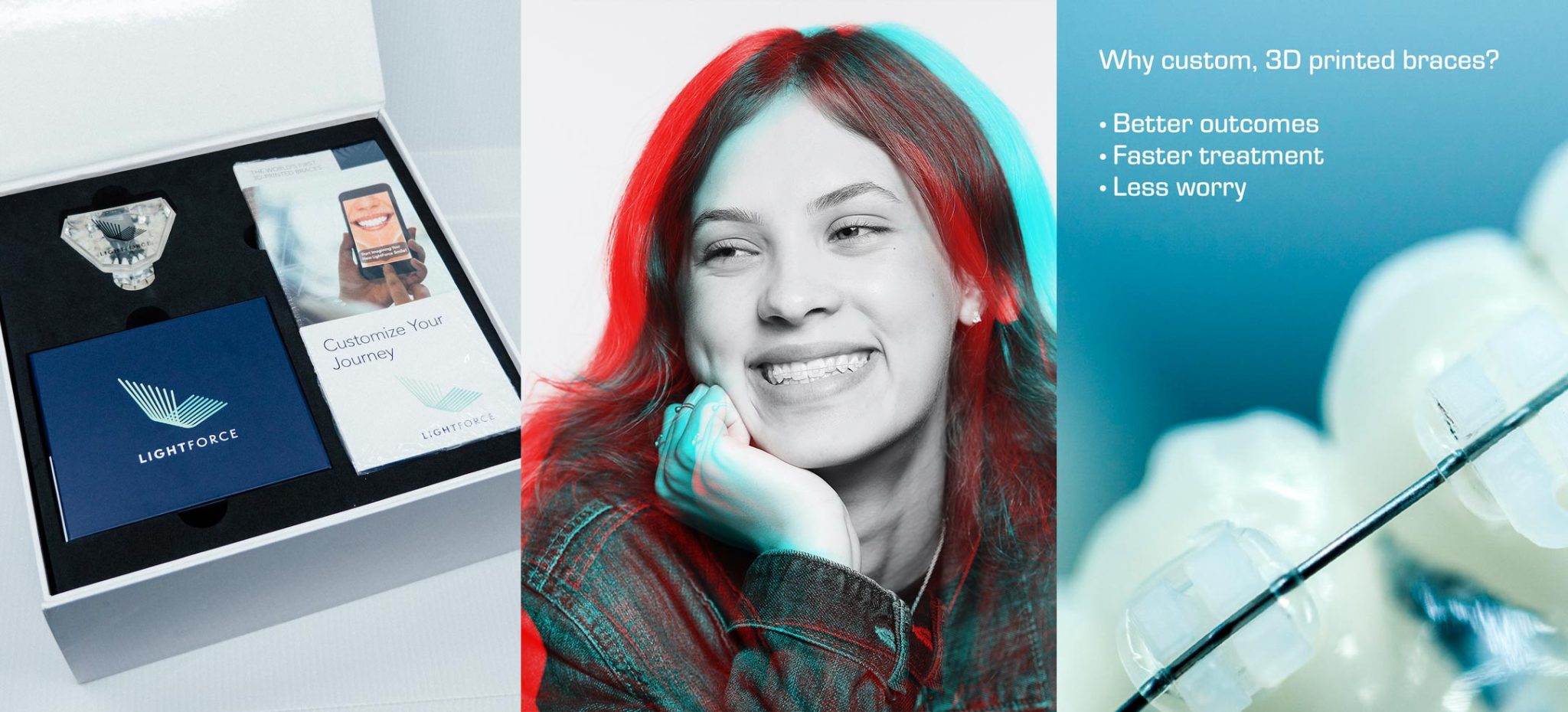 LightForce 3D Braces - Mehta Orthodontics