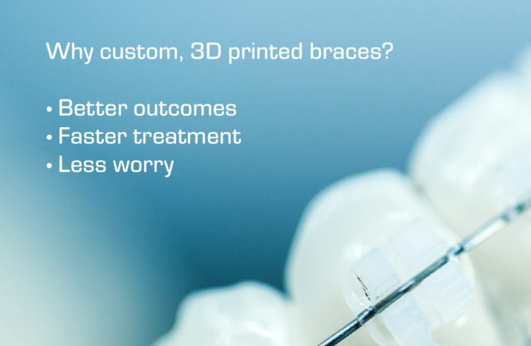 3D Printed Clear Ceramic Braces from Light Force - Mehta Orthodontics