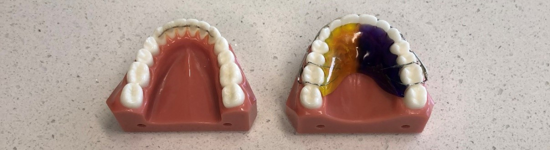 Retainers – Everything You Need to Know - Mehta Orthodontics